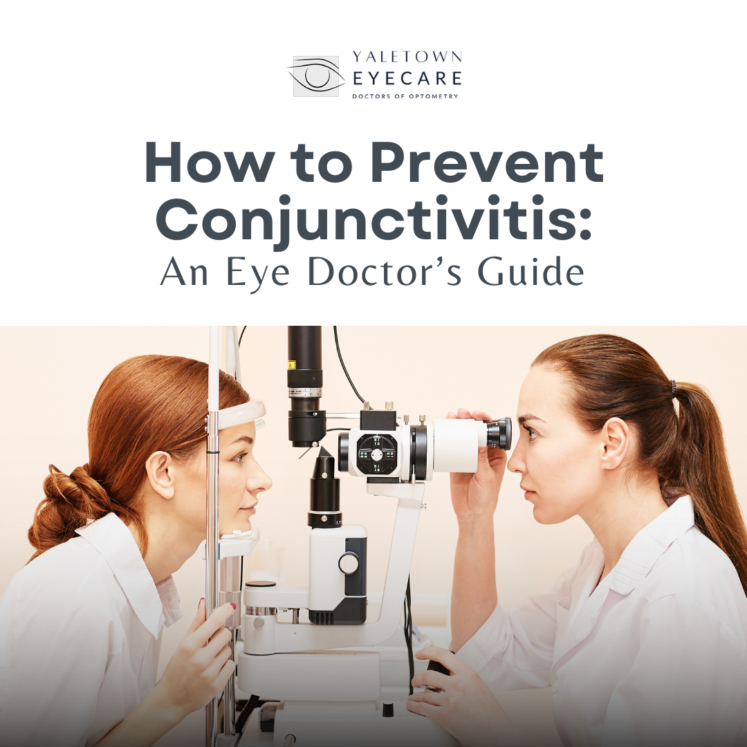 How to Prevent Conjunctivitis: An Eye Doctor's Guide - SOUTHEAST - NEWS ...